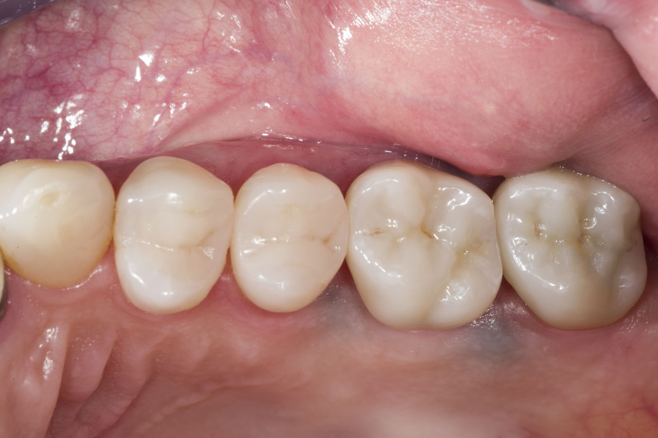 CEREC Case Studies | Dentsply Sirona USA