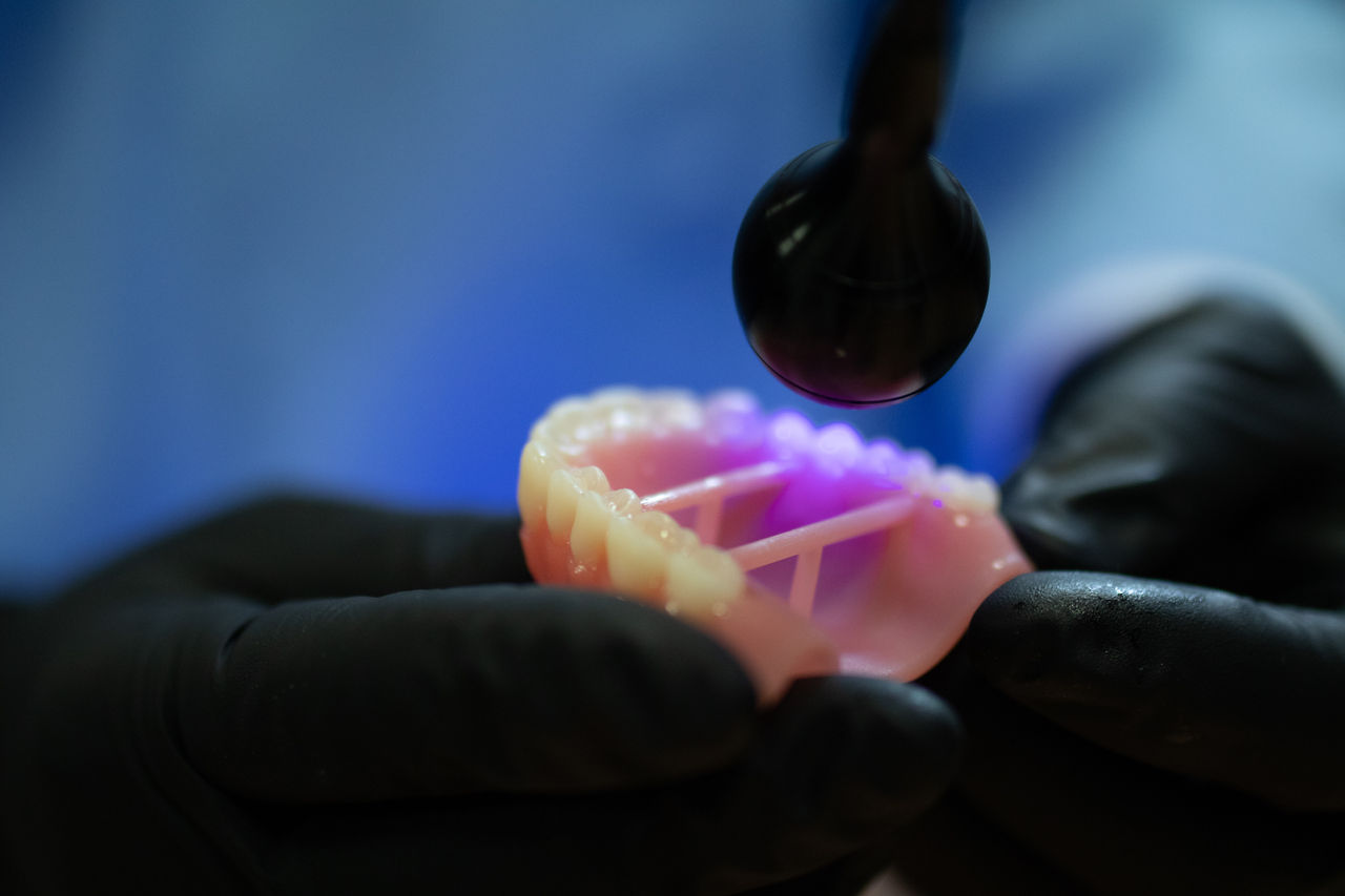 Tips & Tricks for successful 3D printed digital dentures | Dentsply ...