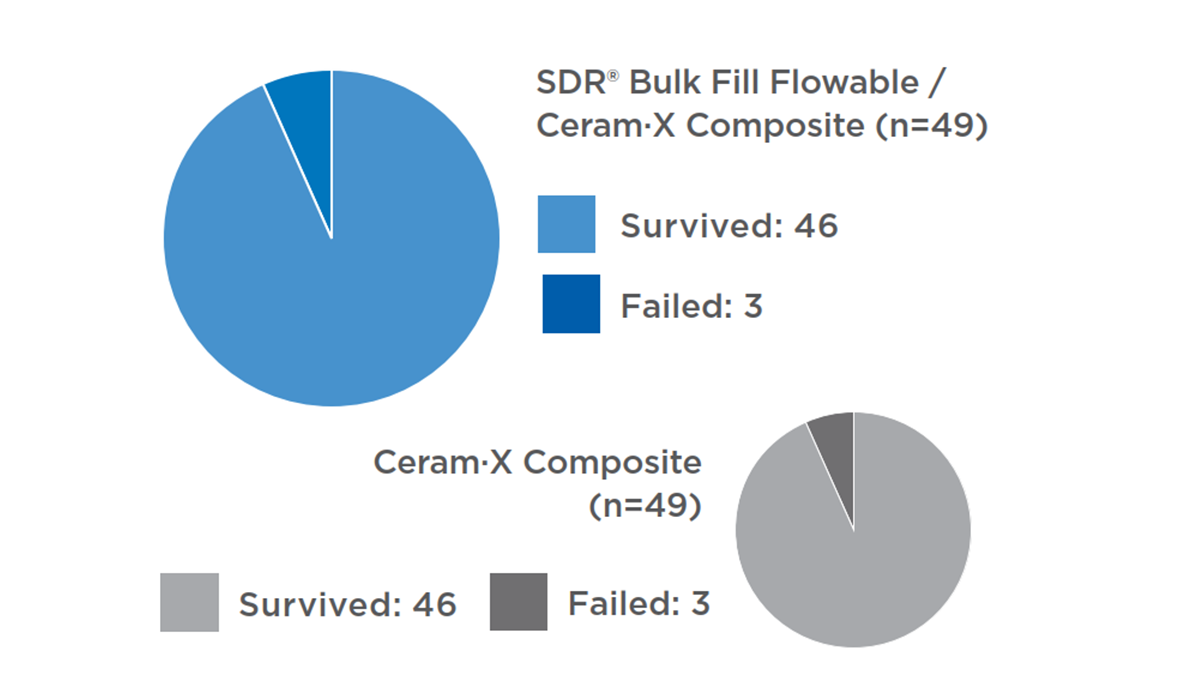 Posterior Composites: Choosing, using, placing | Dentsply Sirona USA
