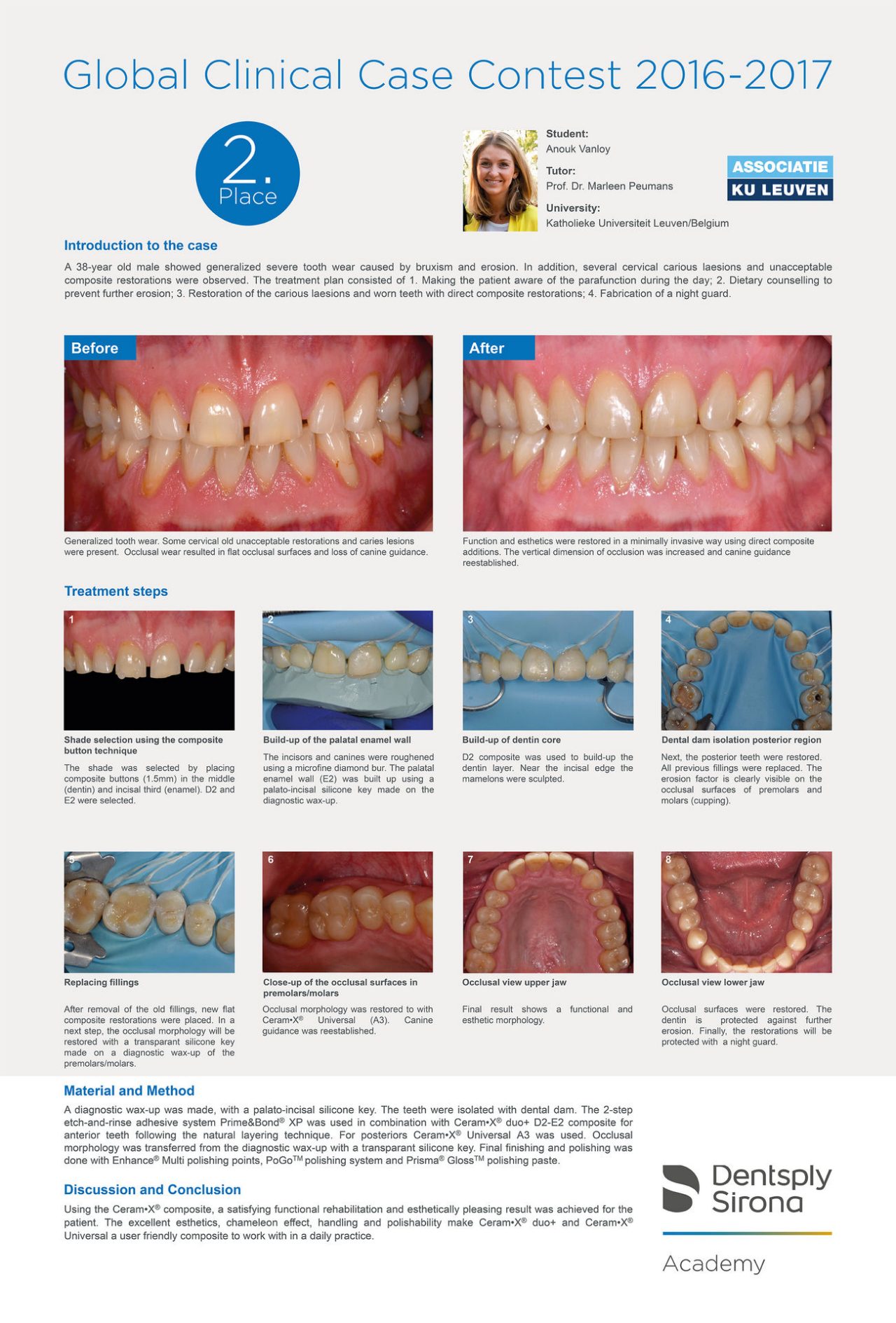 GCCC Global Clinical Case Contest I Dentsply Sirona USA