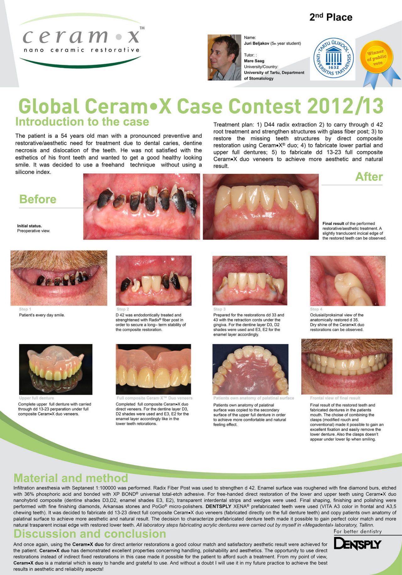 GCCC Global Clinical Case Contest I Dentsply Sirona USA