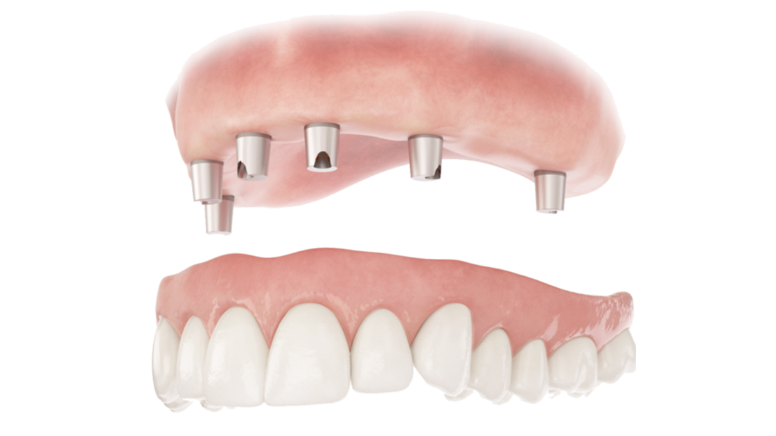 Primelab Partnership Program I Dentsply Sirona USA