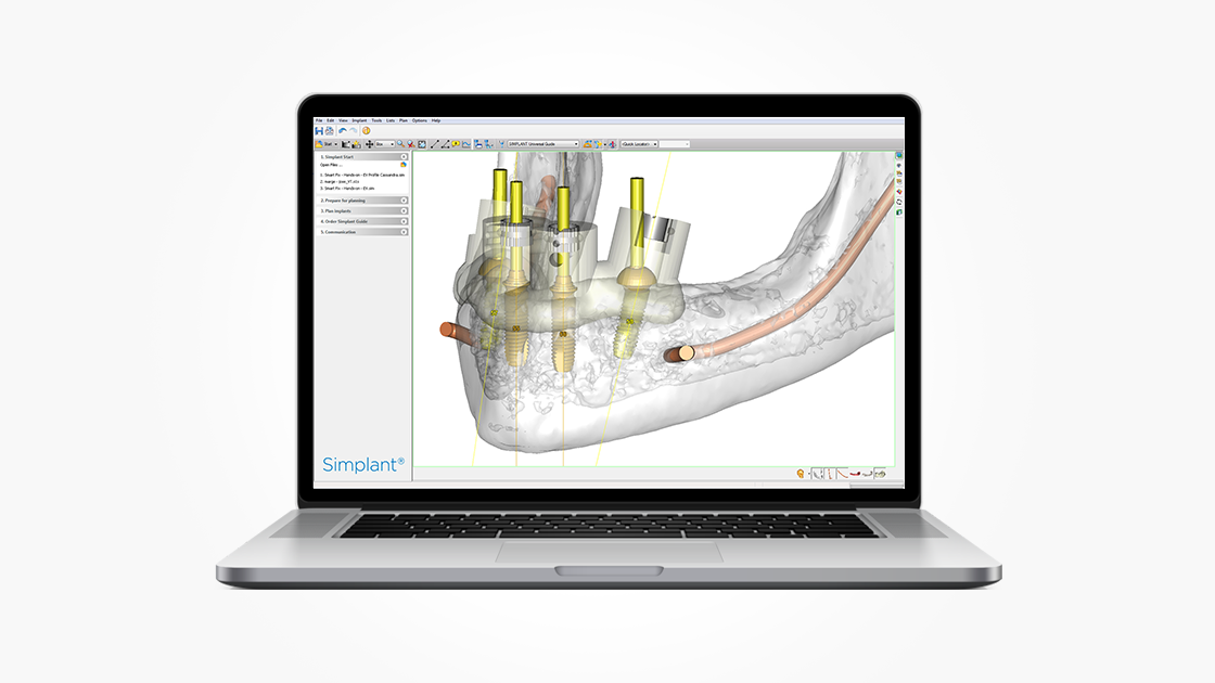 Shop Simplant dental products online | Dentsply Sirona USA