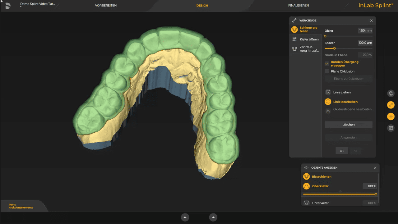 Primeprint Tutorials, Clinical Cases & More | Dentsply Sirona South Africa