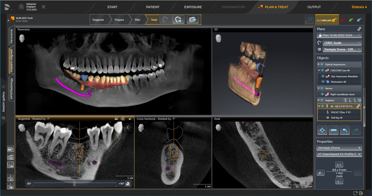 SICAT Dental Software | Dentsply Sirona South Africa
