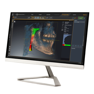 SICAT Dental Software | Dentsply Sirona