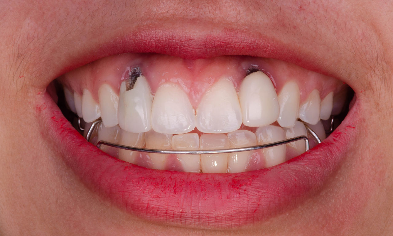 CEREC Case Studies | Dentsply Sirona South Africa