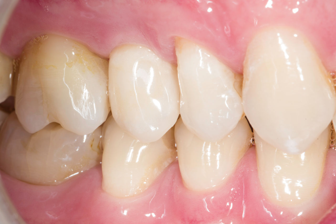 CEREC Case Studies | Dentsply Sirona South Africa