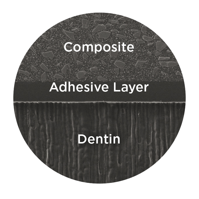 Prime&Bond universal: Adhesivo dental universal | Dentsply Sirona Argentina