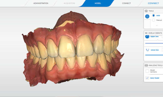 Escáneres intraorales dentales | Dentsply Sirona España