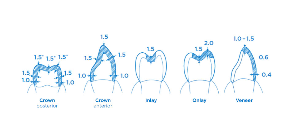 Bloques Celtra Duo | Dentsply Sirona España