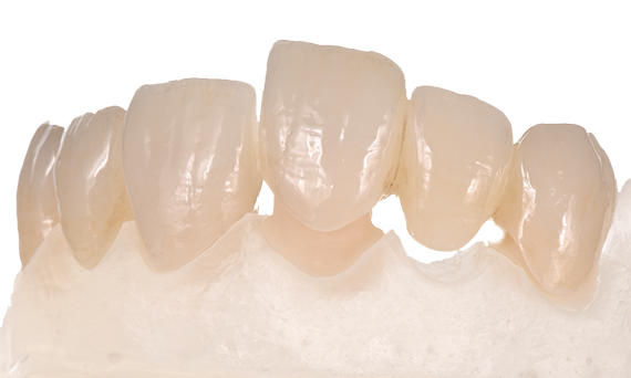 Celtra Press | Dentsply Sirona España