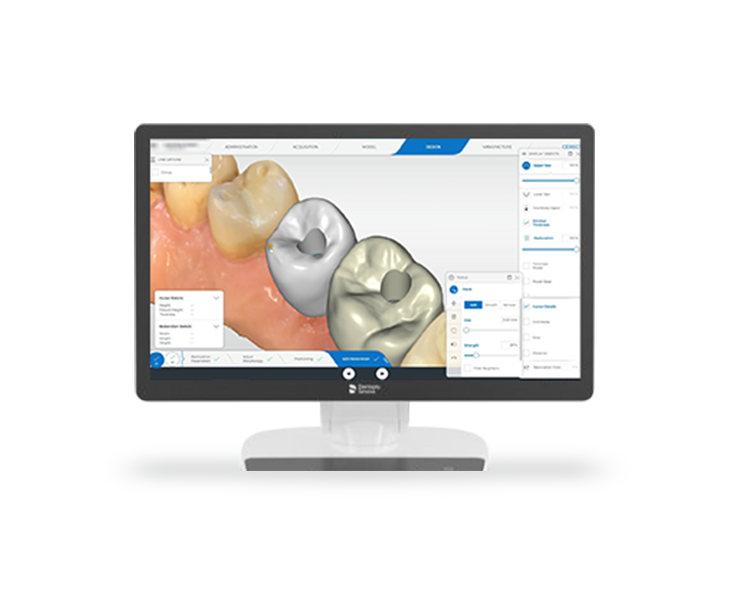 CEREC Tessera: bloques CAD/CAM | Dentsply Sirona España