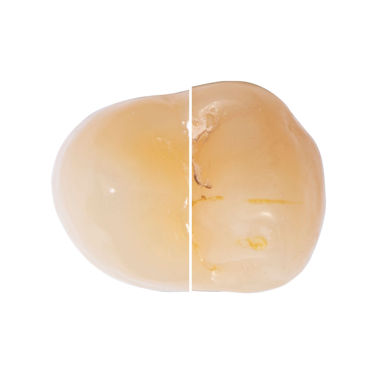 Familia Ceram.x Spectra® ST | Dentsply Sirona España