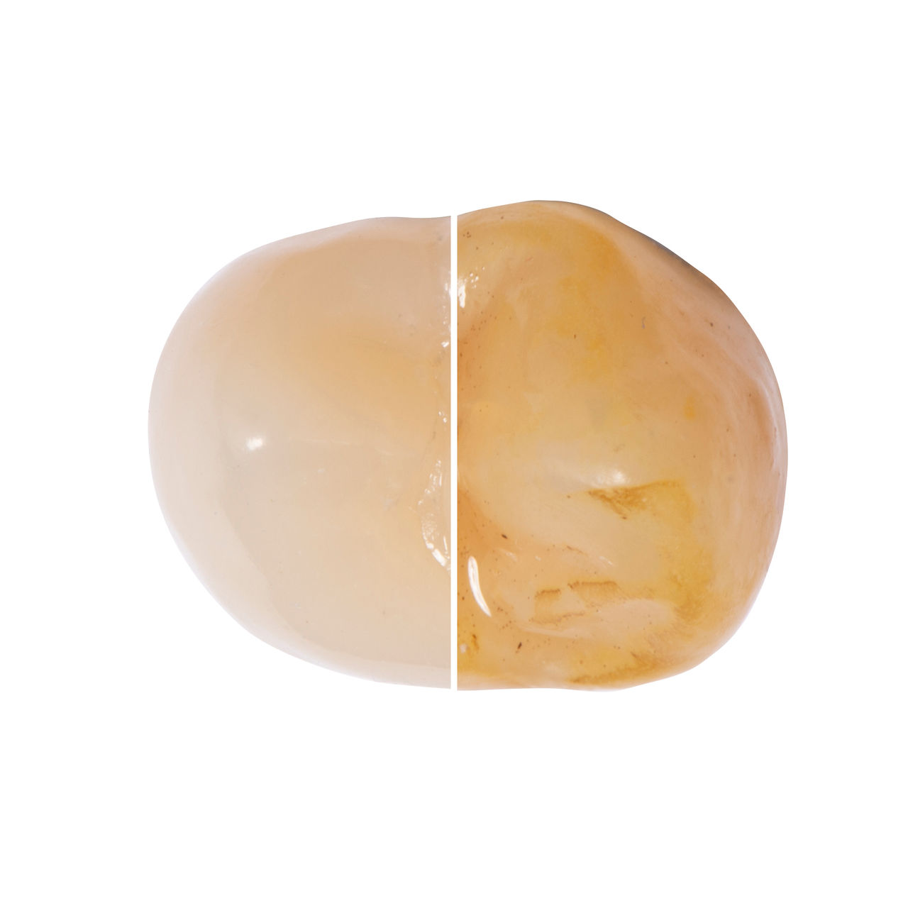 Familia Ceram.x Spectra® ST | Dentsply Sirona España