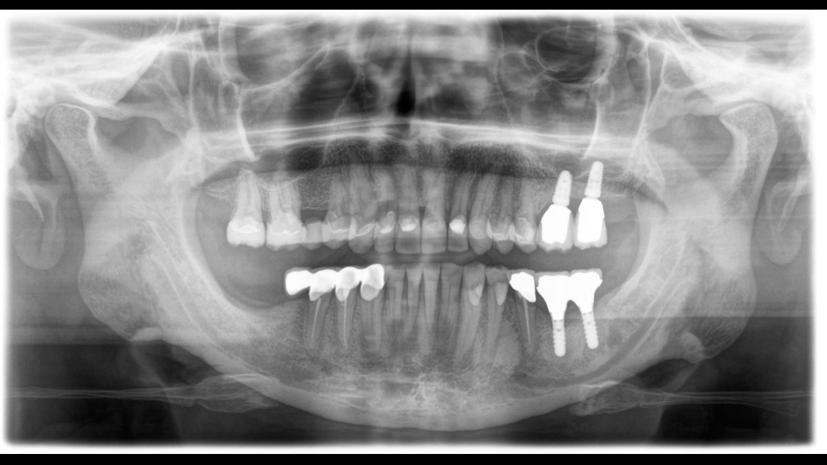 Orthophos S 2D/3D | Dentsply Sirona España