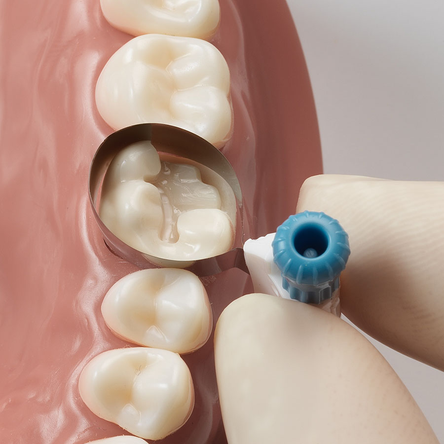 Palodent 360: sistema de matriz circunferencial | Dentsply Sirona España