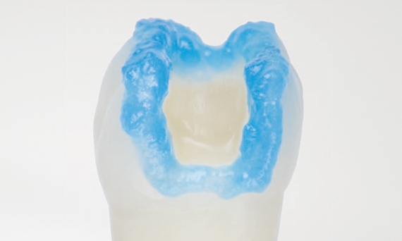 Prime&Bond Active: Adhesivo dental universal | Dentsply Sirona España