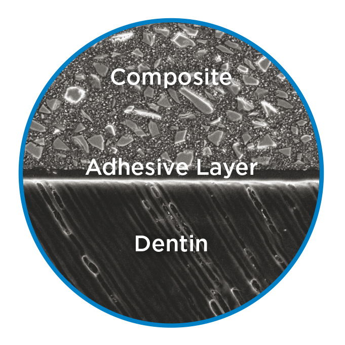 Prime&Bond Active: Adhesivo dental universal | Dentsply Sirona España