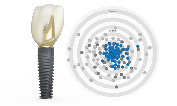 DS OmniTaper Implant System España