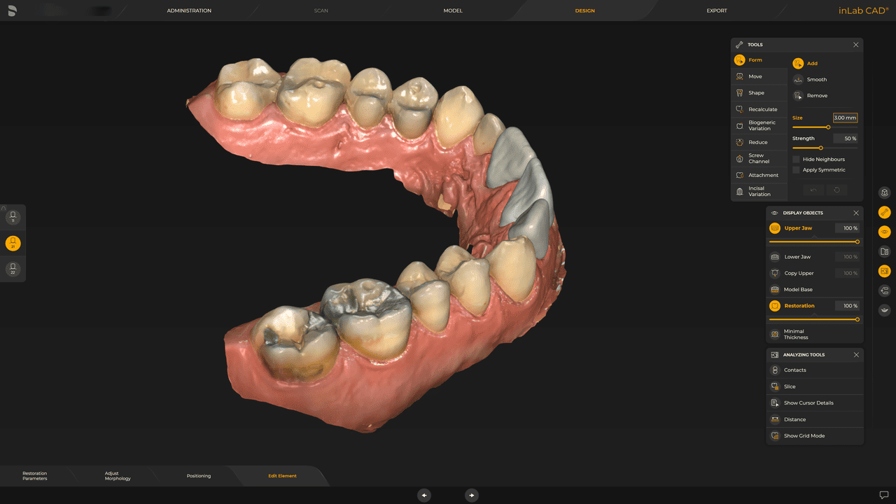 Equipo CAD/CAM | inLab para laboratorios dentales | Dentsply Sirona México