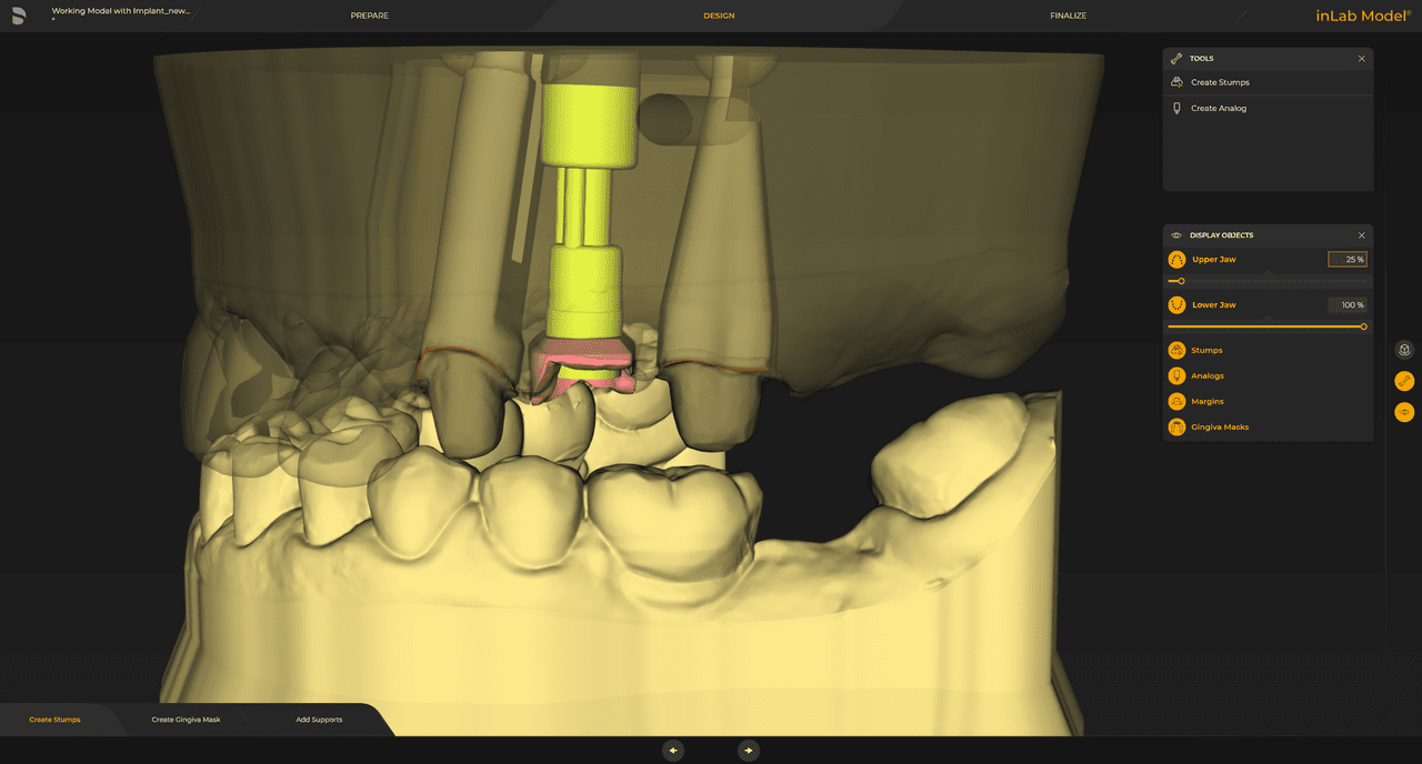 Software inLab: Software dental CAD | Dentsply Sirona Peru