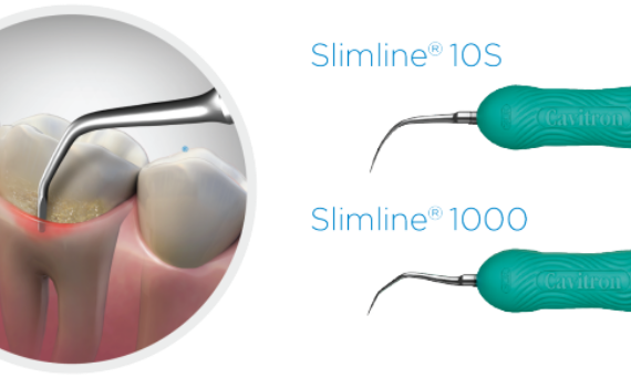 Système de détartrage ultrasonique Cavitron 300 | Dentsply Sirona Canada