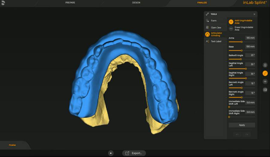 Cas cliniques Primeprint | Dentsply Sirona Canada