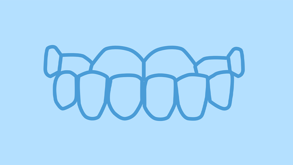 Cas et résultats SureSmile | Dentsply Sirona France