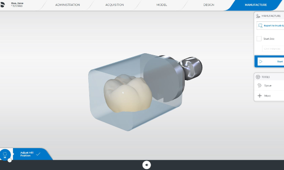 Software CEREC | Dentsply Sirona Italia