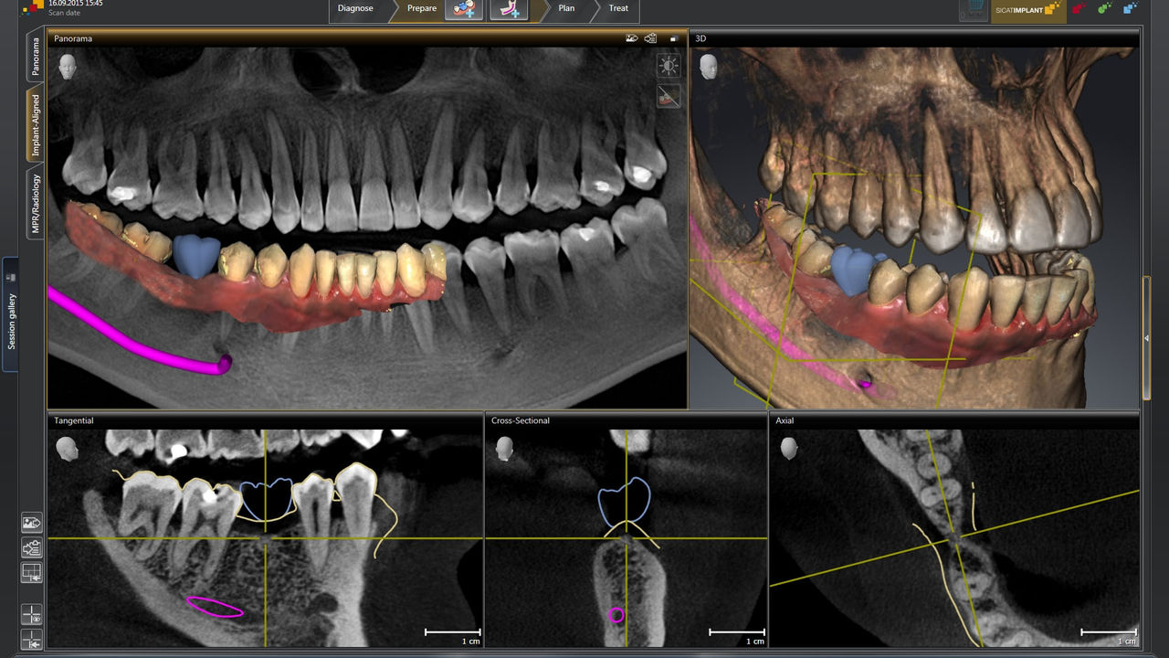 Software odontoiatrico SICAT | Dentsply Sirona Italia