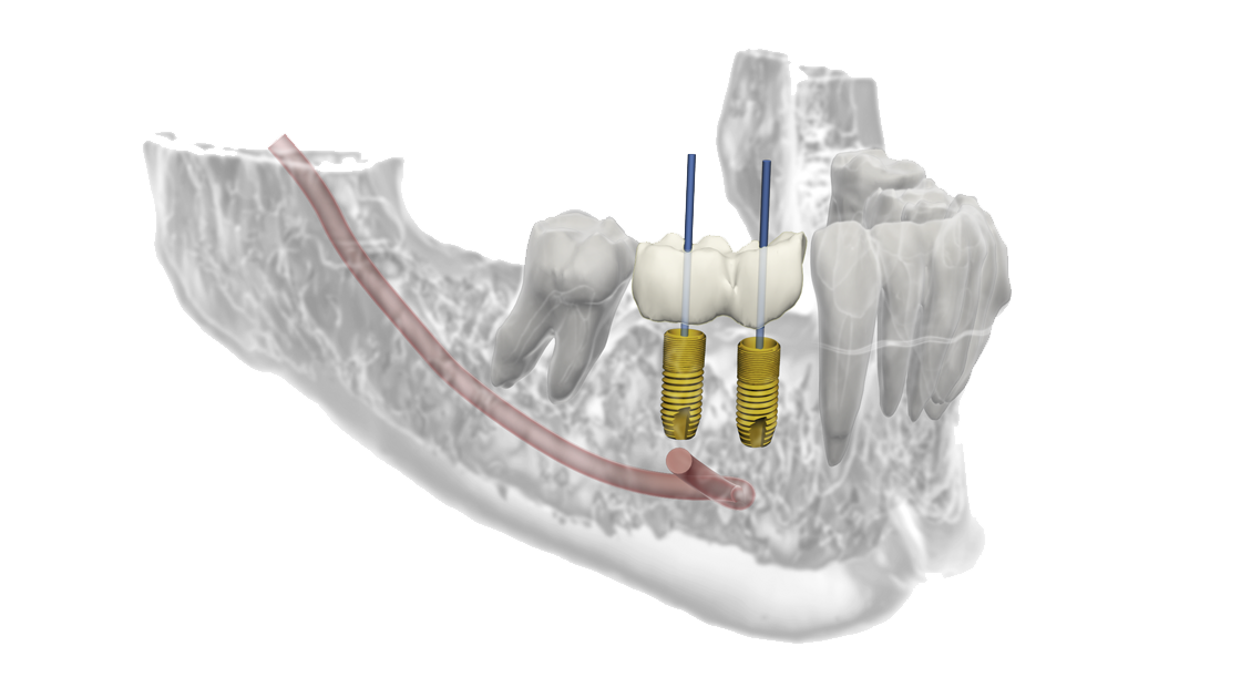 Sidexis 4: Software di radiologia dentale | Dentsply Sirona Italia