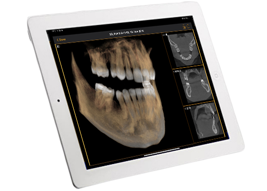 App per radiologia dentale per iPad Sidexis iX | Dentsply Sirona Italia