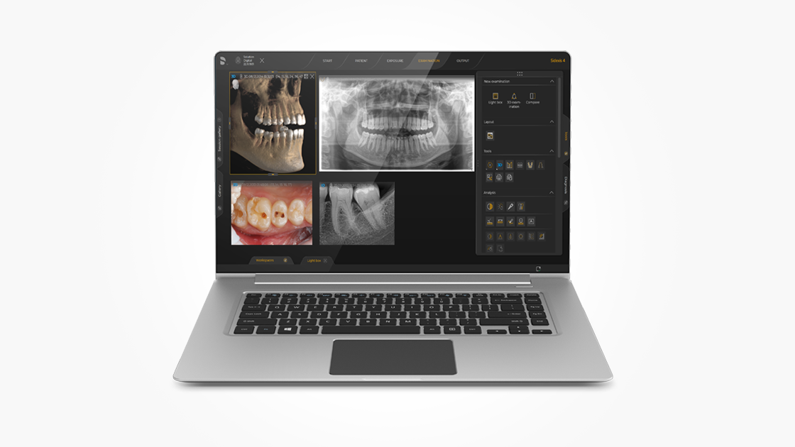 Tandheelkundige röntgensoftware | Dentsply Sirona België