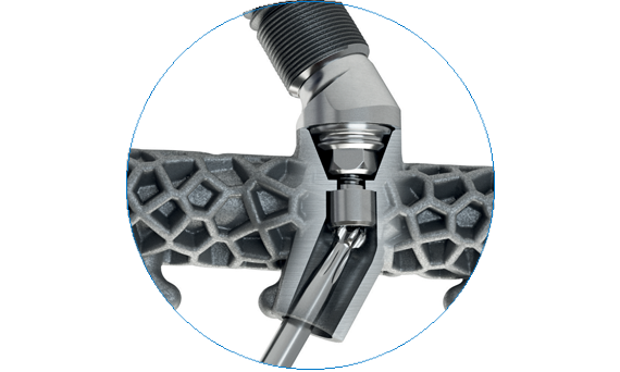 SmartFix implantaatbehandelingsconcept | Dentsply Sirona Nederland