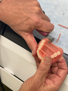 Lucitone Digital Print Denture voor Primeprint Solution Curriculum ...
