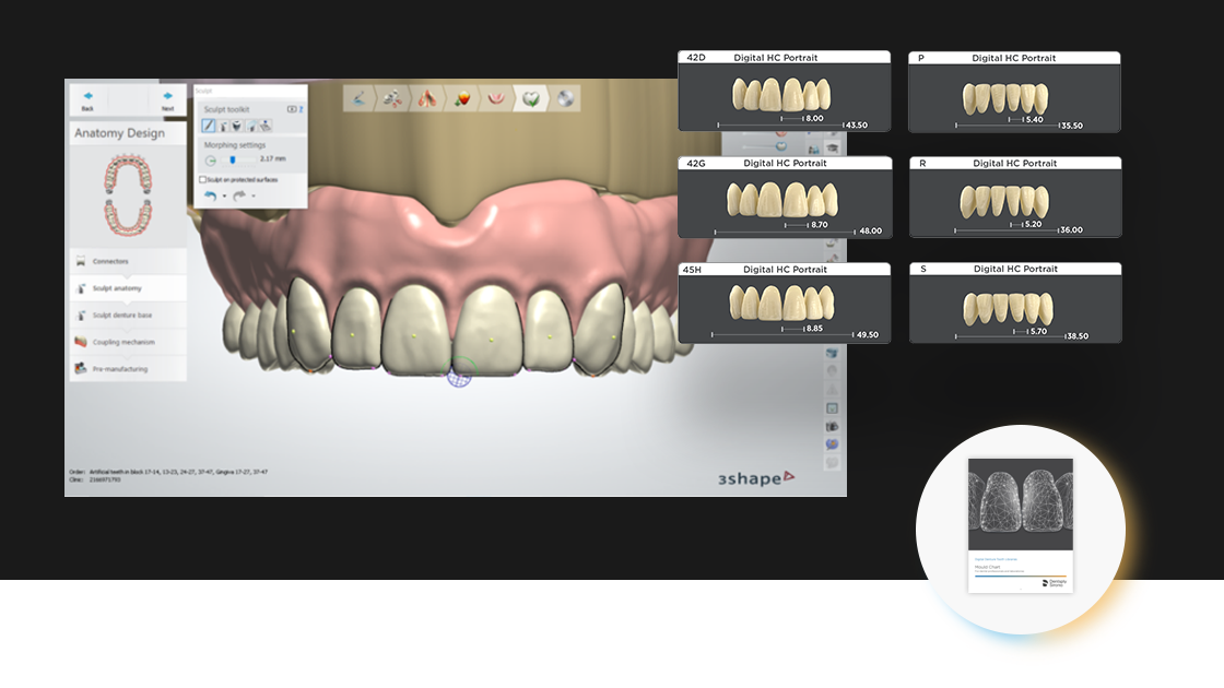 Workflow van Lucitone Digital Print Denture I Dentsply Sirona Netherlands