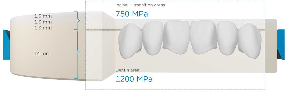 Cercon ht ML: Zircônia dentária | Dentsply Sirona Brasil
