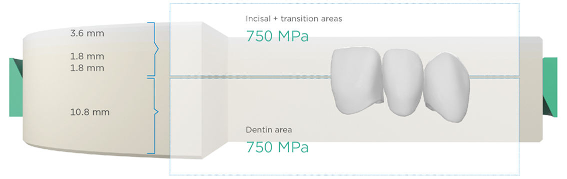 Cercon xt ML | Dentsply Sirona