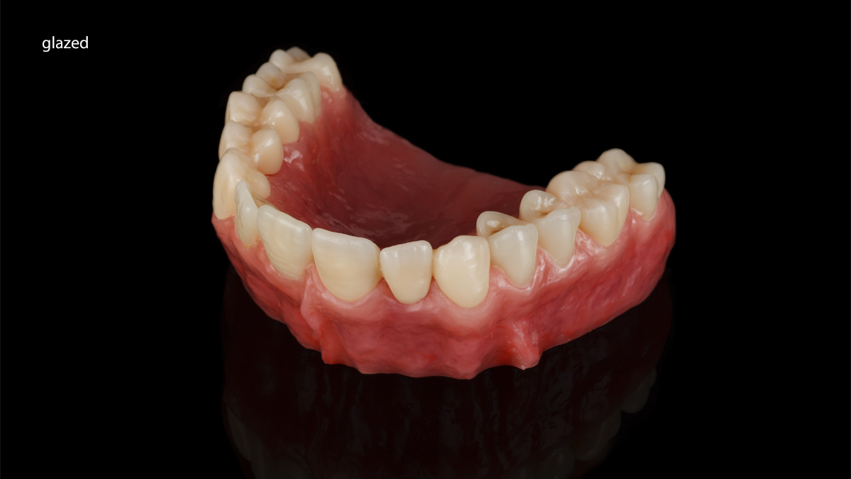 Cercon xt ML | Dentsply Sirona Brasil