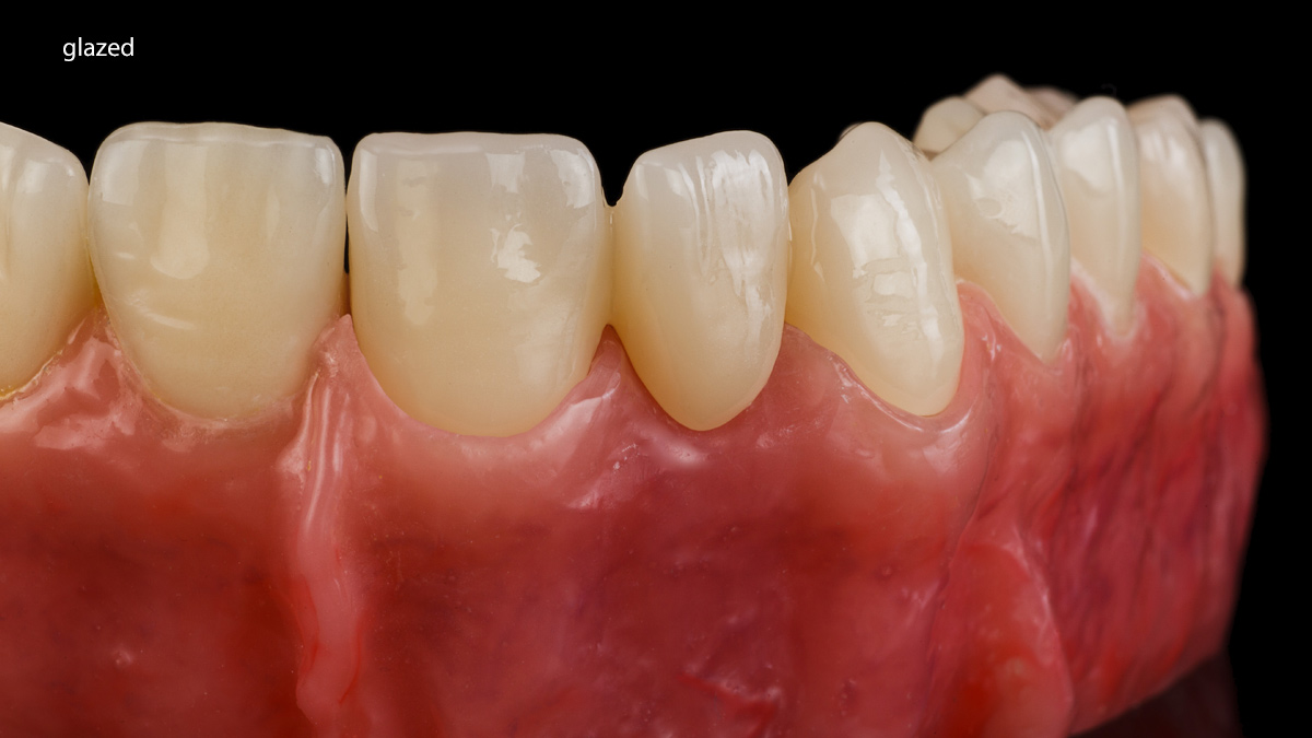 Cercon xt ML | Dentsply Sirona Brasil