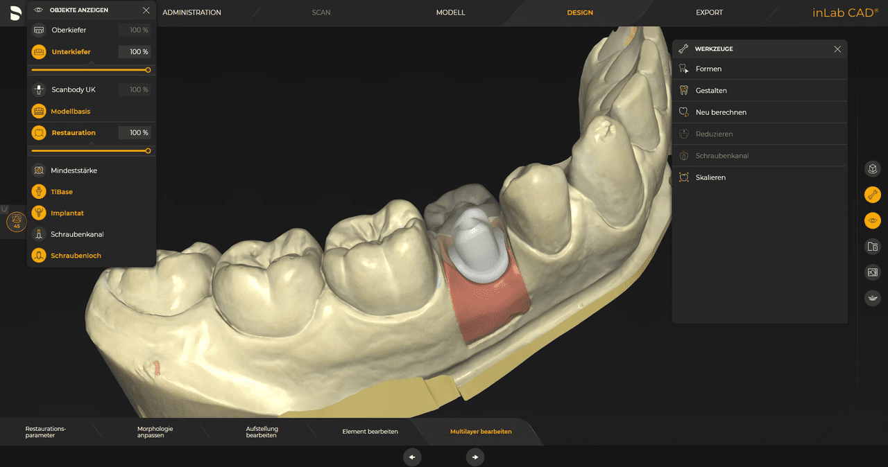 Software inLab: Software odontológico CAD | Dentsply Sirona